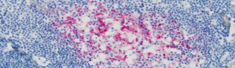 CWD Prions Remain Infectious after Passage Through the Digestive System ...